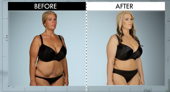 See The Shocking Botched Before And After Pics E News